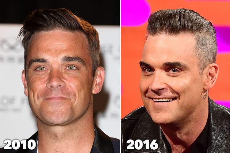 Robbie Williams loves having botox | RITZ